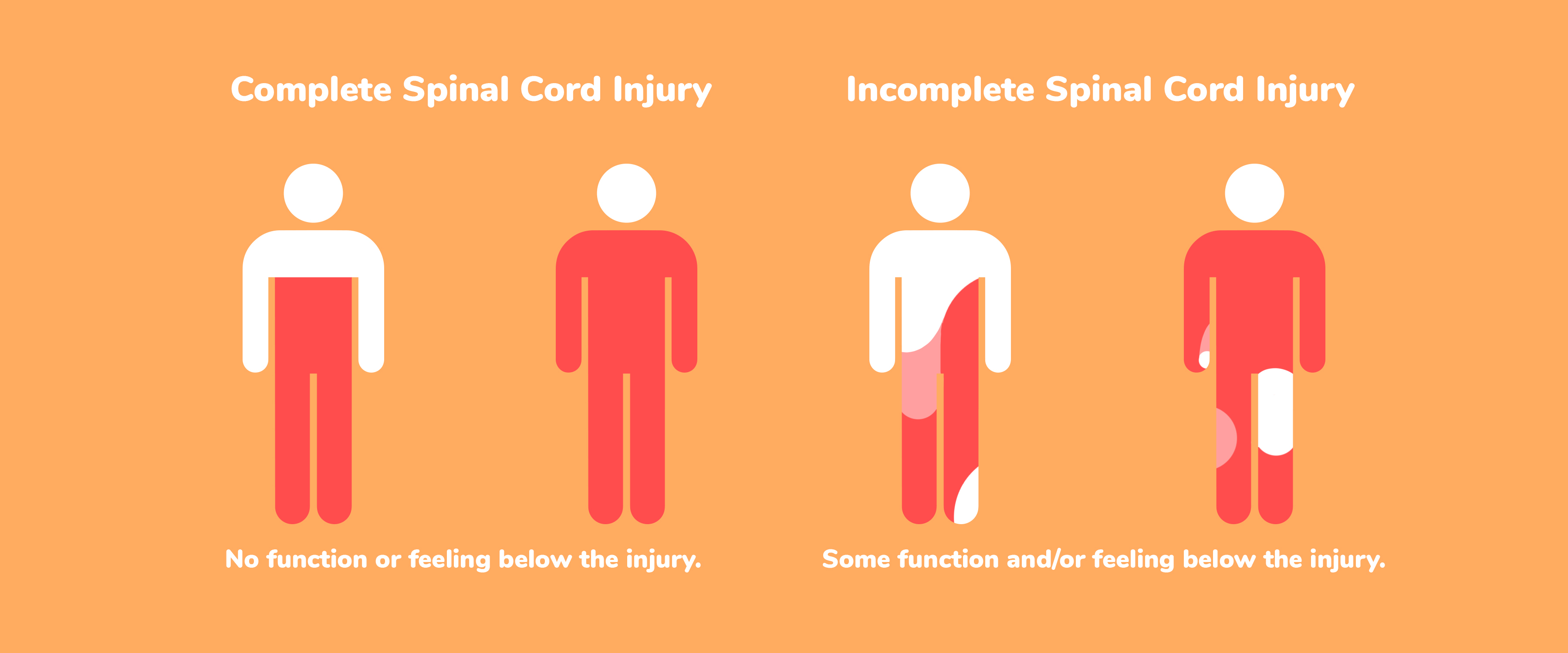 Difference Between A Complete Spinal Cord Injury And Incomplete Spinal