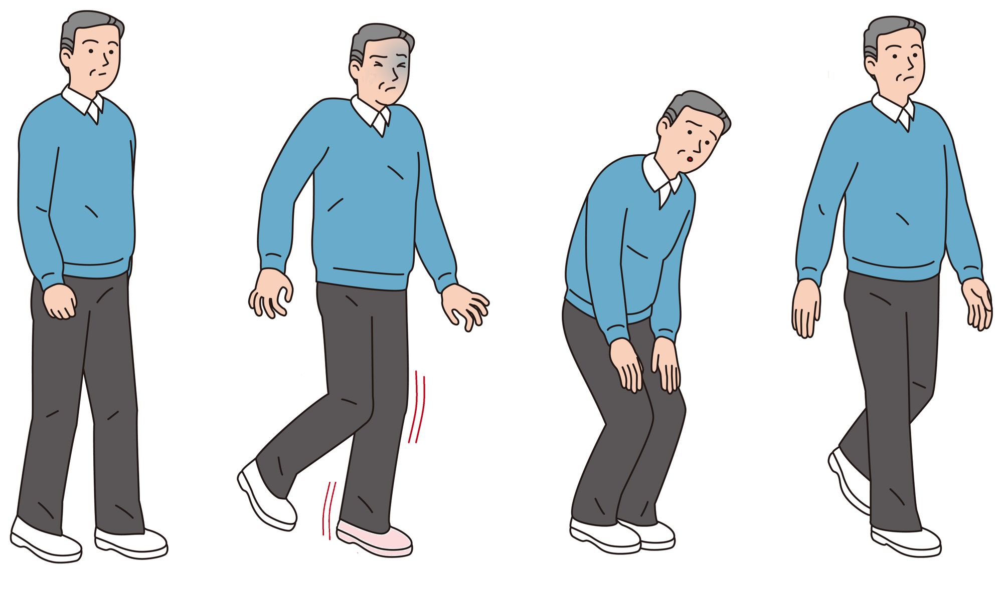 Walking Gait Abnormalities Boston Children S Hospital Vrogue co